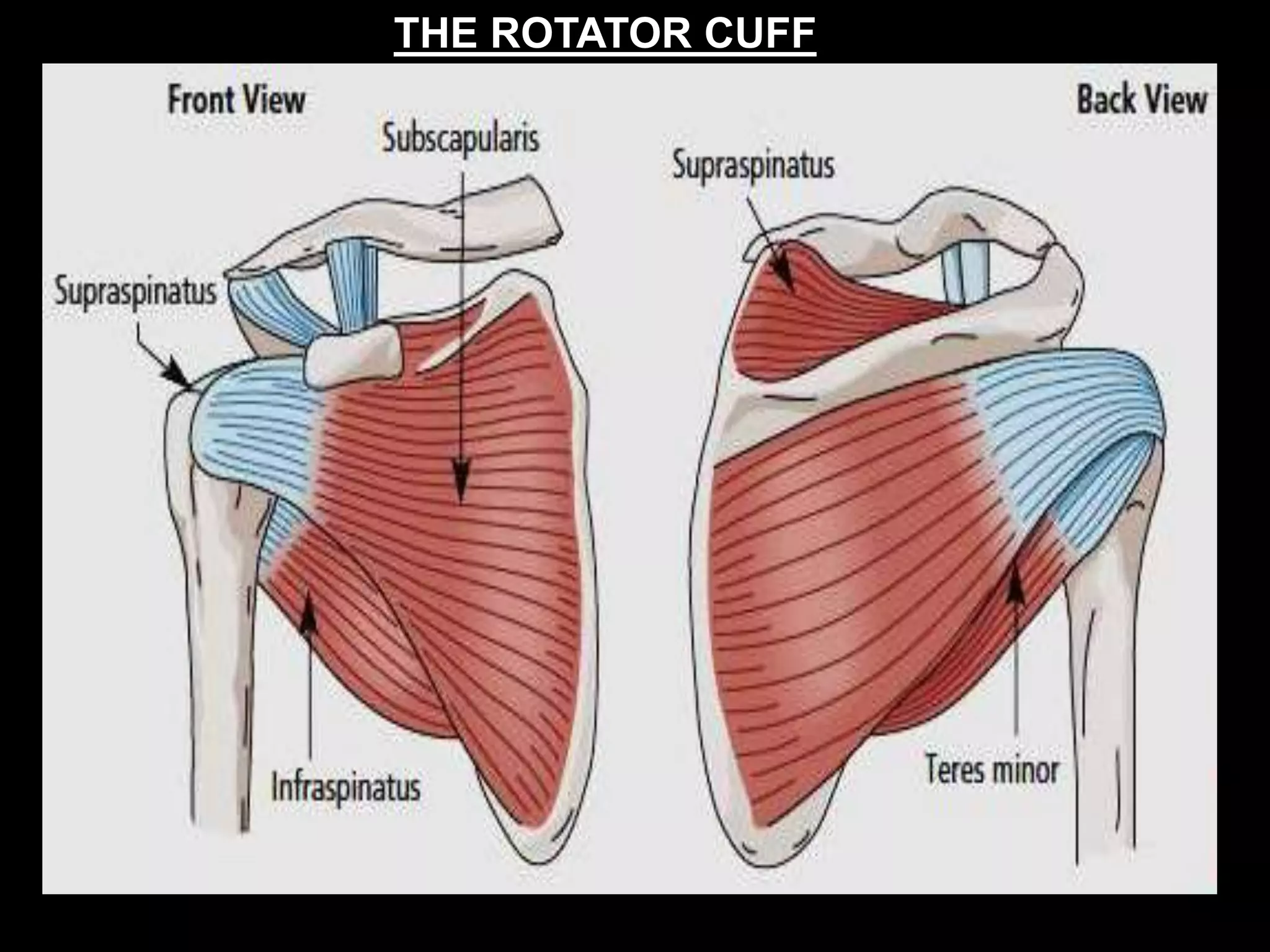 Shoulder impingement syndrome | PPTX
