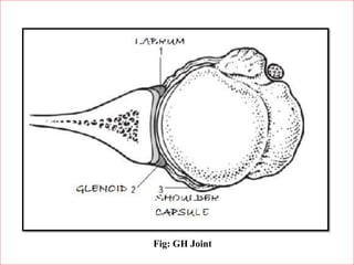 Shoulder impingement syndrome | PPTX