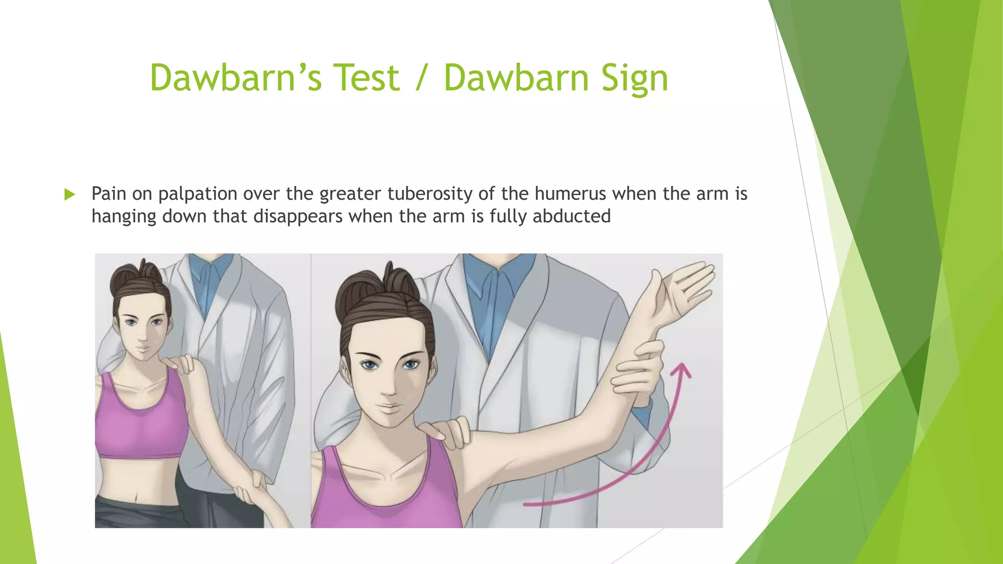 Shoulder Injection | PPTX