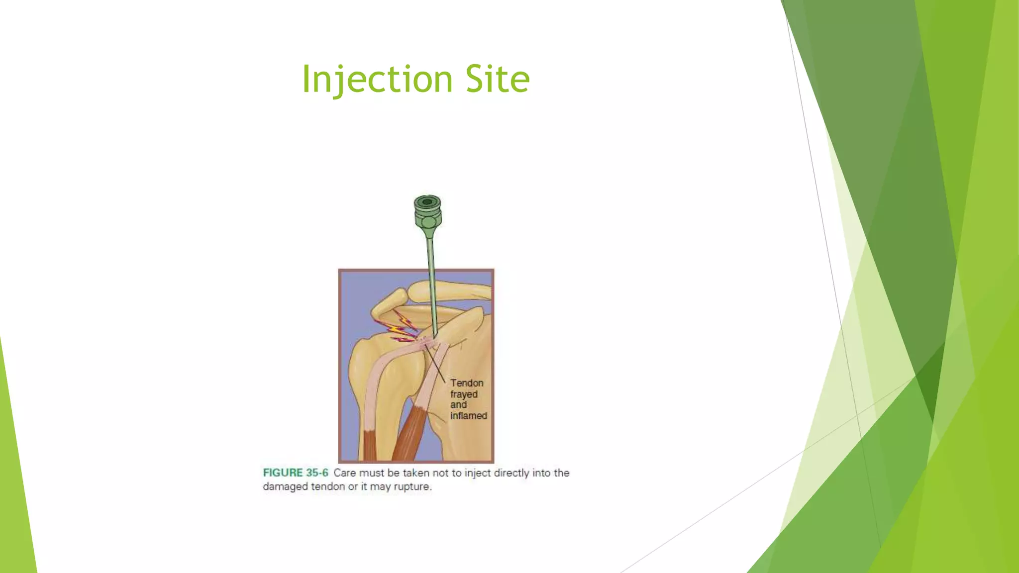 Shoulder Injection | PPTX