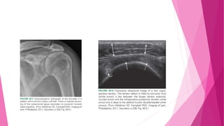 Shoulder Injection | PPTX