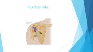 Shoulder Injection | PPTX