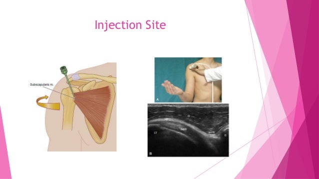 Shoulder Injection