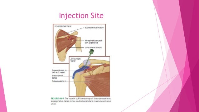 Shoulder Injection