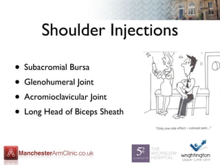Shoulder injections mike walton | PPT