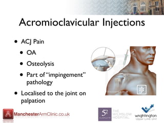 Shoulder injections mike walton | PDF