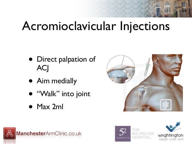 Shoulder Injections Mike Walton