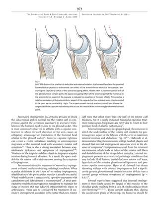 Shoulder Injuries | Throwing Athlete | Orthopedic Surgeon Vail Colorado ...