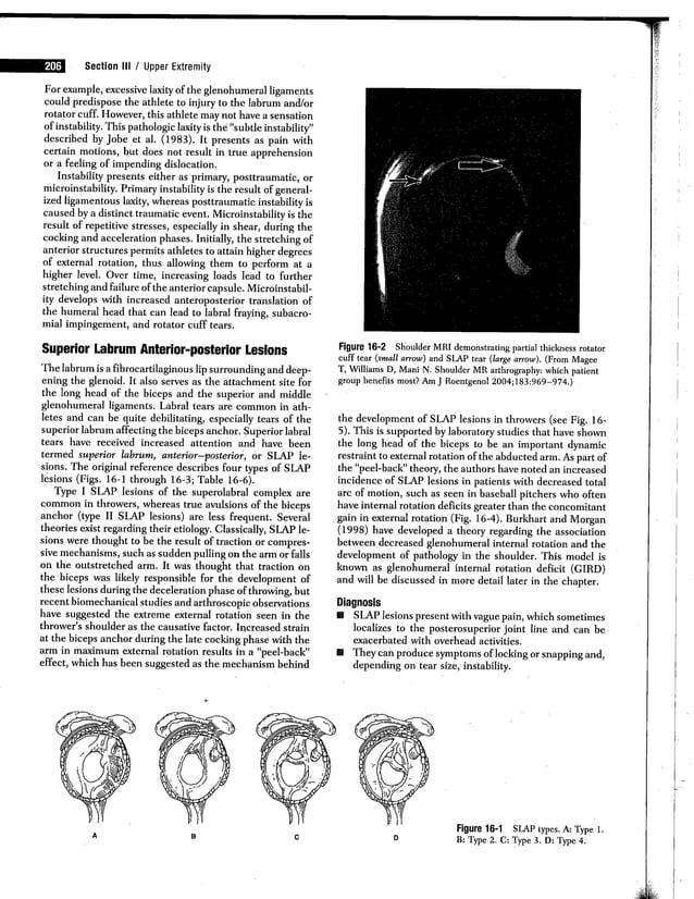 Shoulder Injuries in Throwing Athletes | Peter Millett MD - Shoulder ...