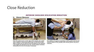 Shoulder Injury klasifikasi dan terapi.pptx