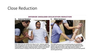 Shoulder Injury klasifikasi dan terapi.pptx