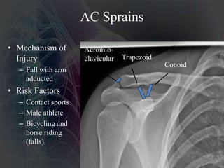 Shoulder injury and back pain | PPTX