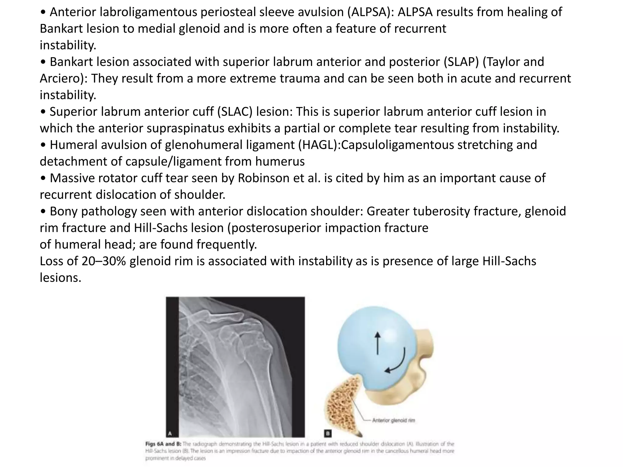 Shoulder instability-1.pptx