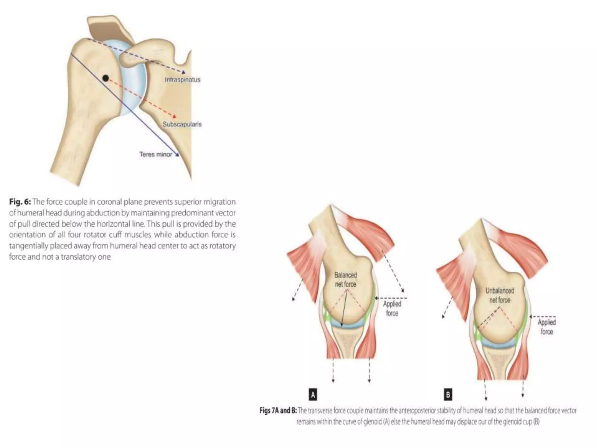 Shoulder instability-1.pptx