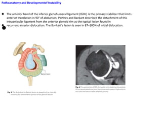 Shoulder instability-1.pptx