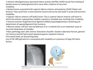 Shoulder instability-1.pptx
