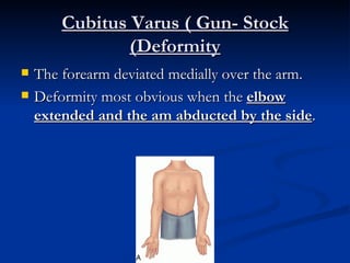 Orthopedics 5th year, 2nd lecture (Dr. Ariwan) | PPT | Death, Injury ...