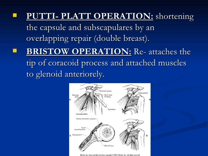 Orthopedics 5th year, 2nd lecture (Dr. Ariwan)