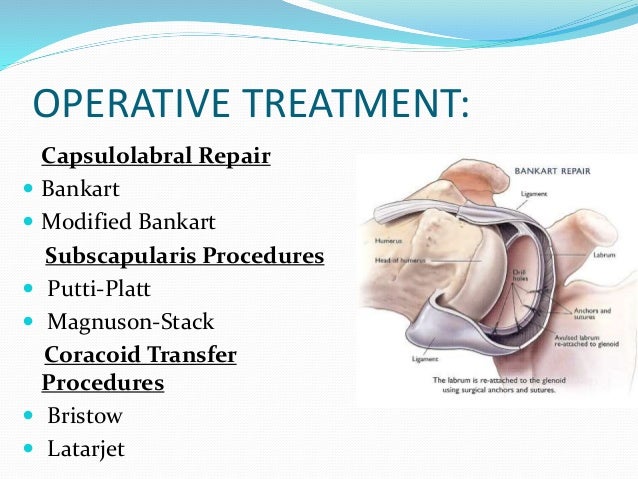 Shoulder Instability