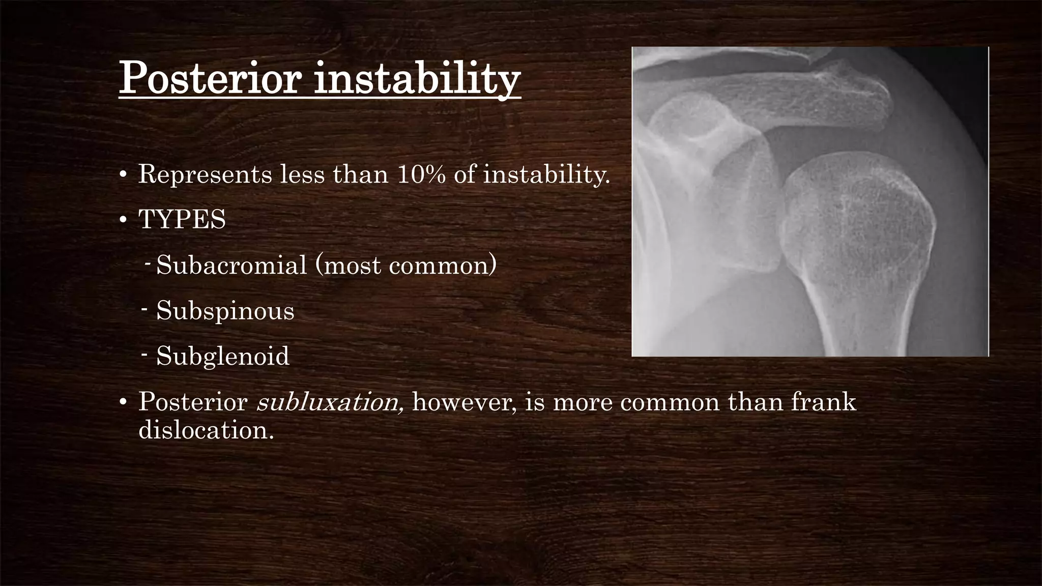 Shoulder instability | PPTX