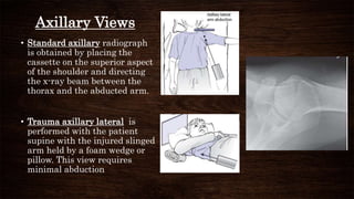 Shoulder instability | PPT