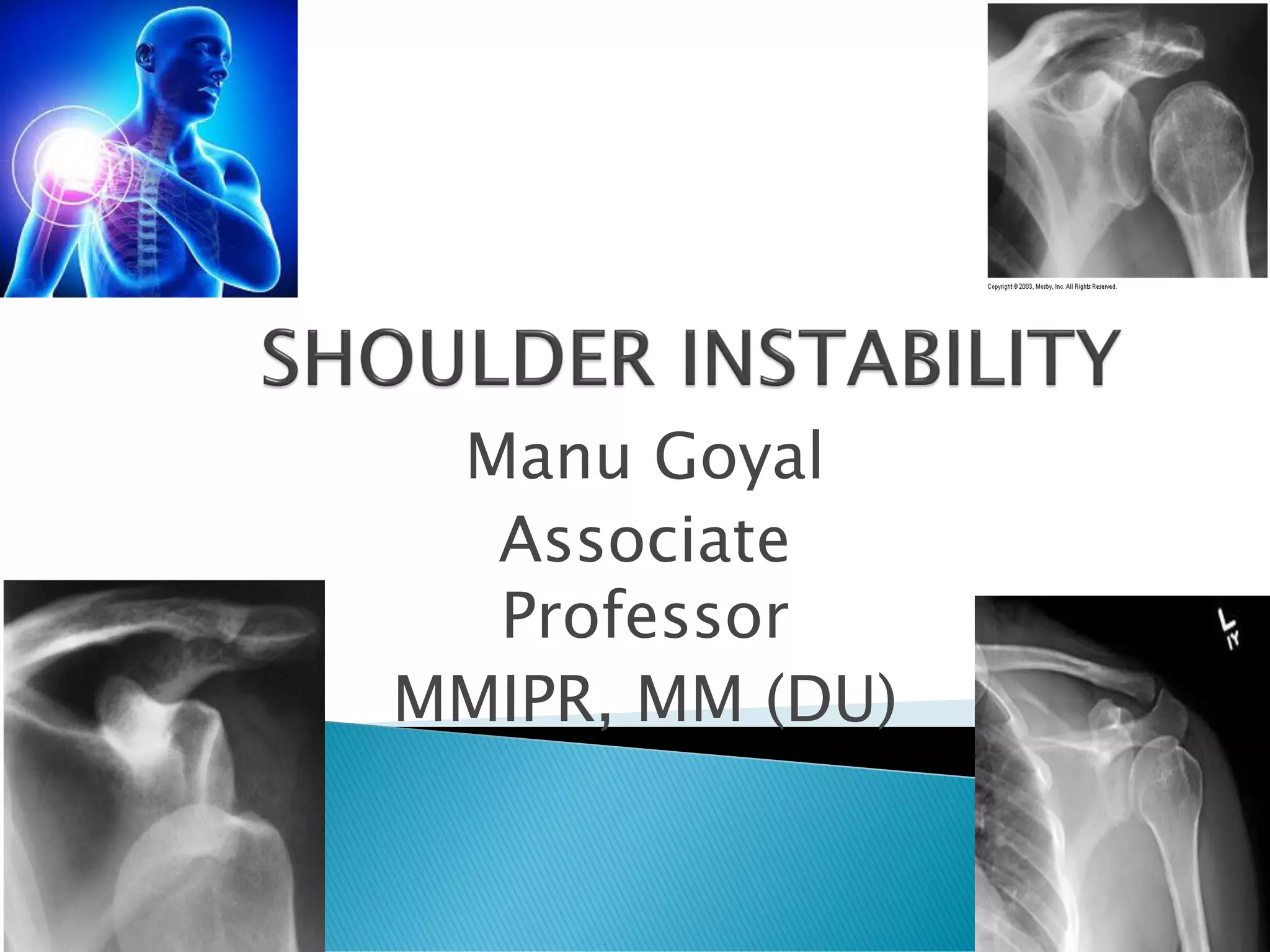 Shoulder Instability | PDF | Death, Injury, or Military Conflict ...