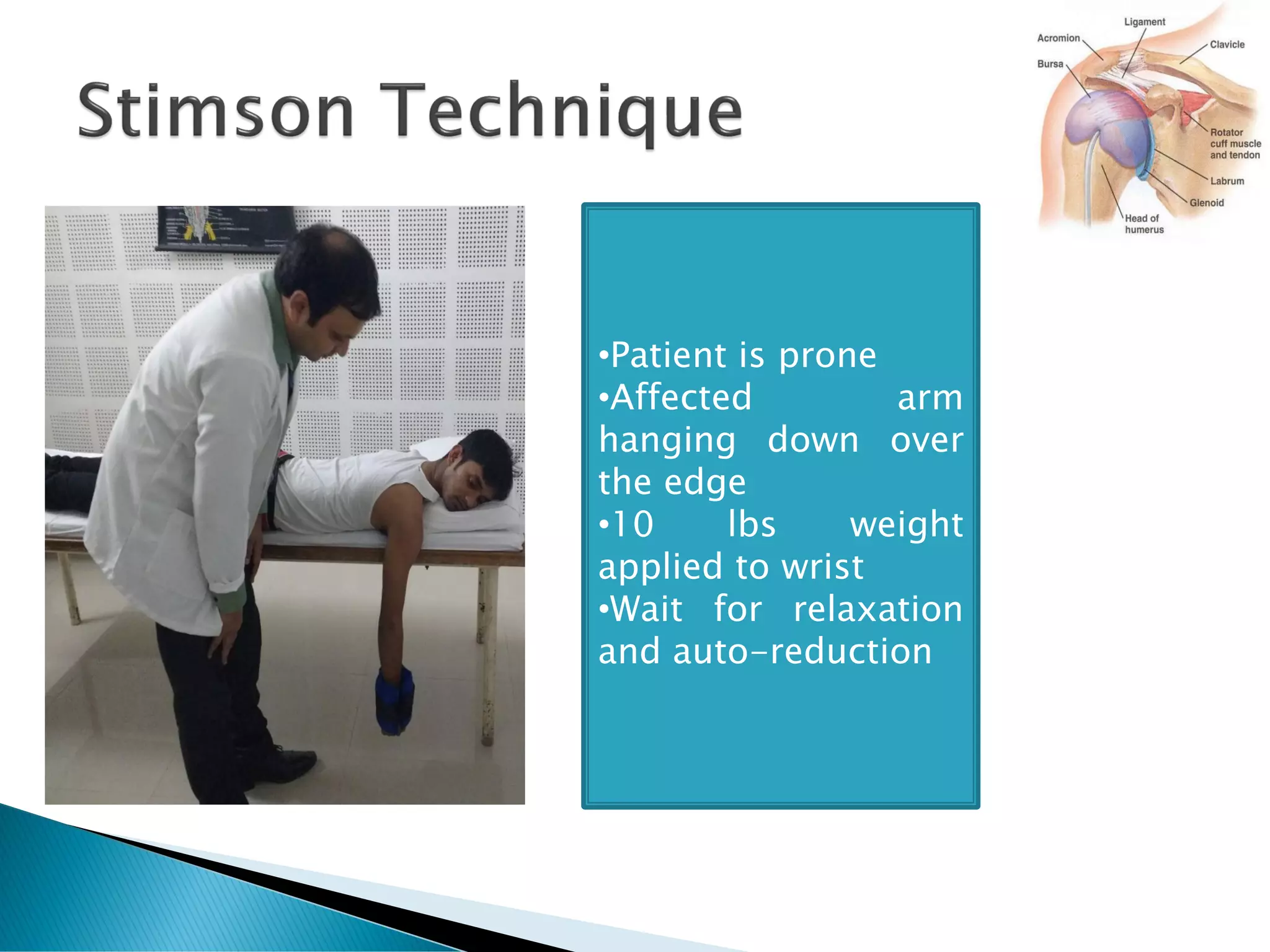 Shoulder Instability | PDF | Death, Injury, or Military Conflict ...