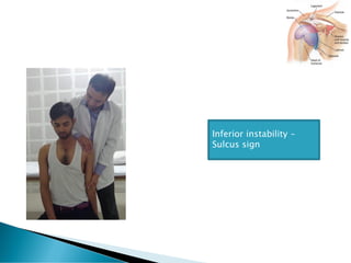 Shoulder Instability | PPT