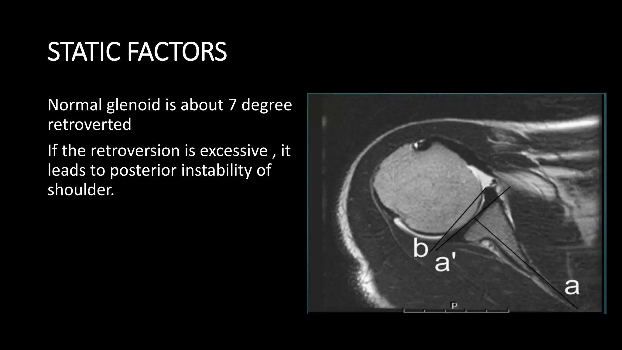 SHOULDER INSTABILITY AIIMS JODHPUR SEMINAR | PPTX