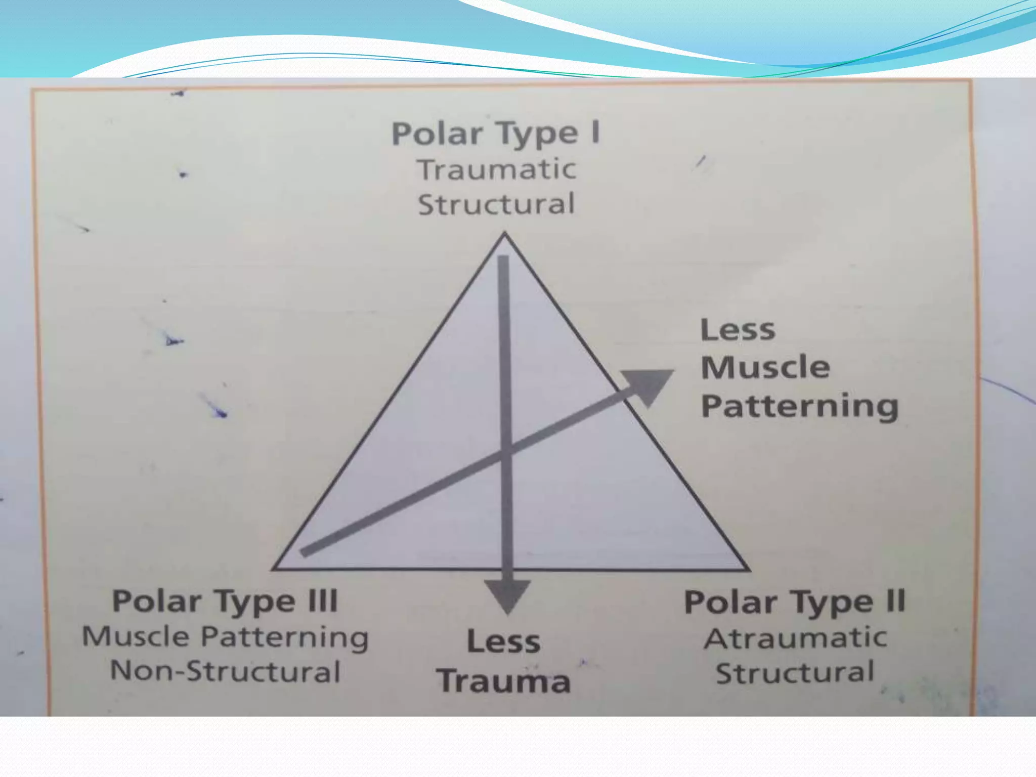 Shoulder instability (anatomy,types, management ) | PPTX