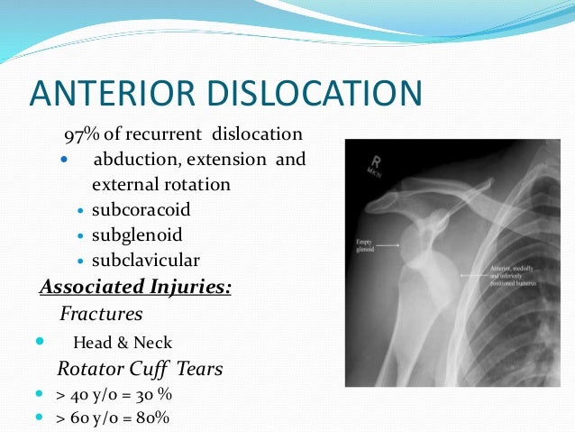 Shoulder instability (anatomy,types, management )