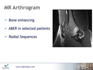 Shoulder Instability Sports - Decision Making | PDF | Death, Injury, or ...