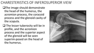 SHOULDER JOINT.pptx