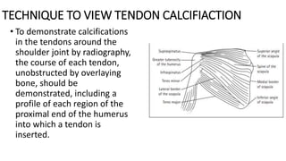 SHOULDER JOINT.pptx