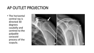 SHOULDER JOINT.pptx