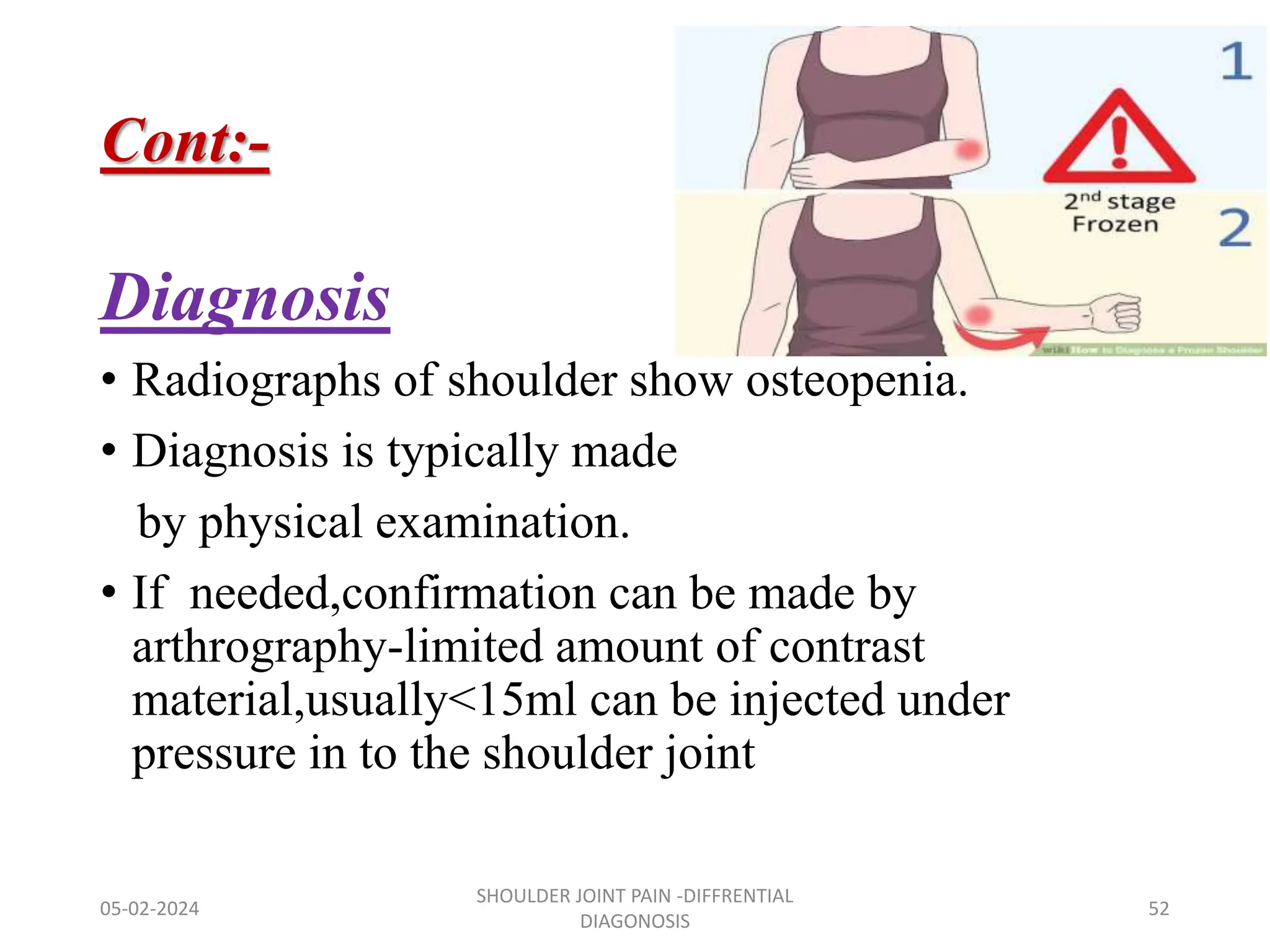 Shoulder Joint - Introduction, Examination,Frozen shoulder # ...