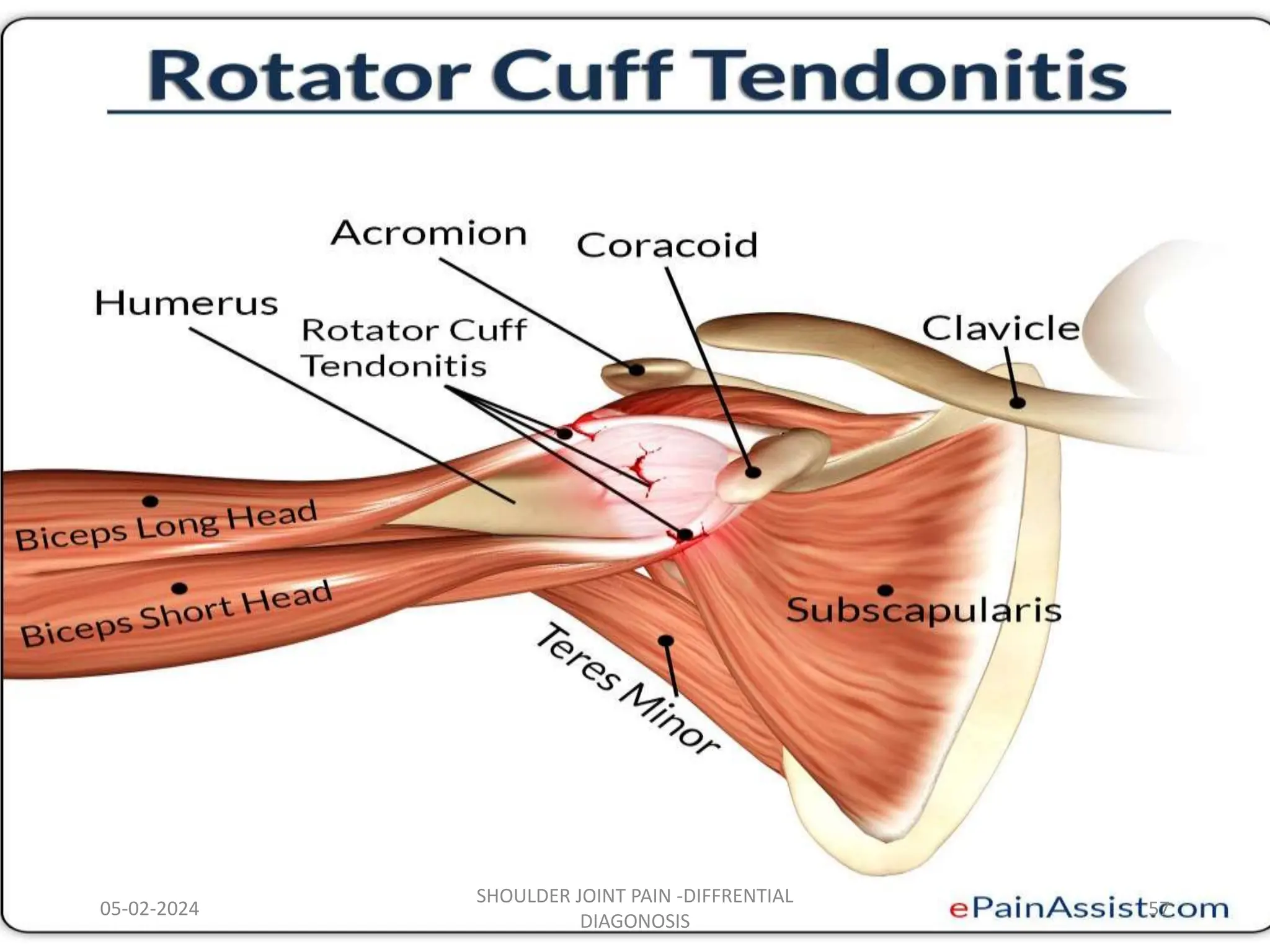 Shoulder Joint - Introduction, Examination,Frozen shoulder # ...