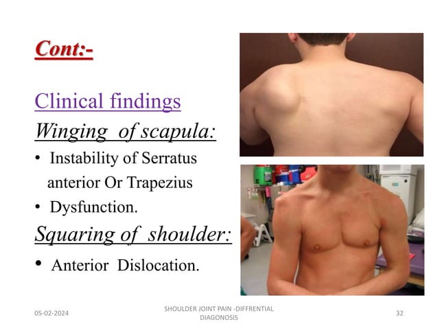 Shoulder Joint - Introduction, Examination,Frozen shoulder # ...