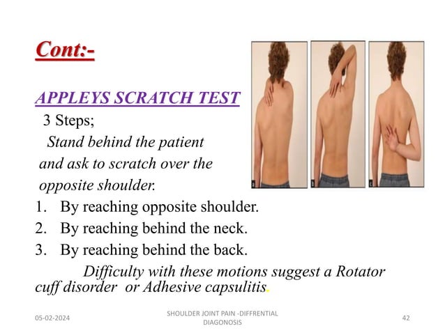 Shoulder Joint - Introduction, Examination,Frozen shoulder # ...