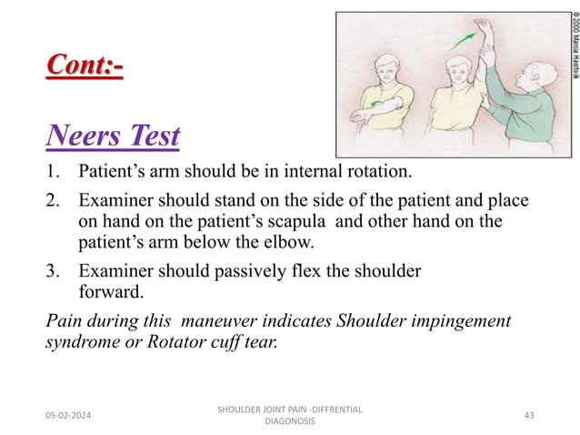 Shoulder Joint - Introduction, Examination,Frozen shoulder # ...