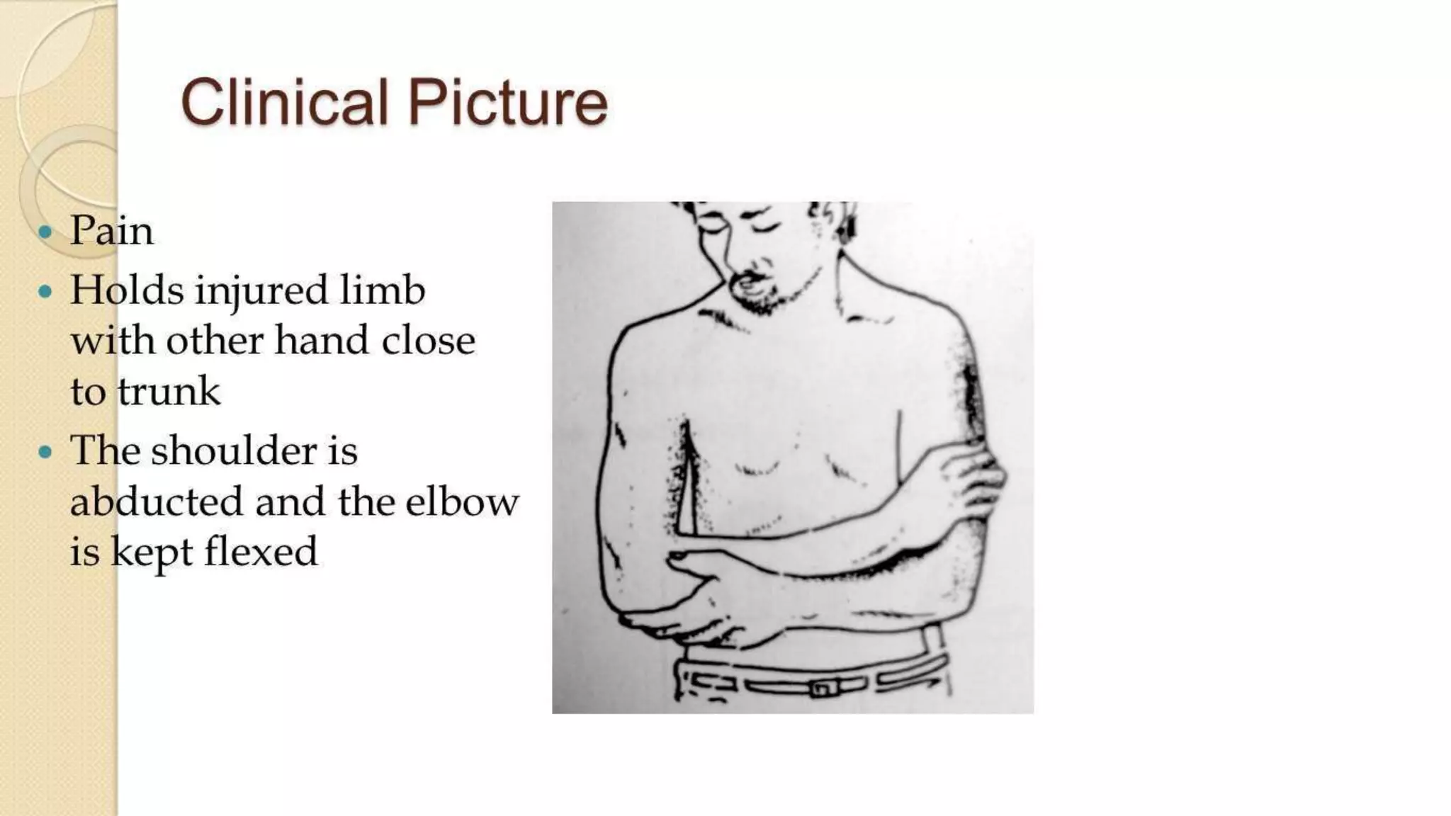Shoulder joint instability | PPT