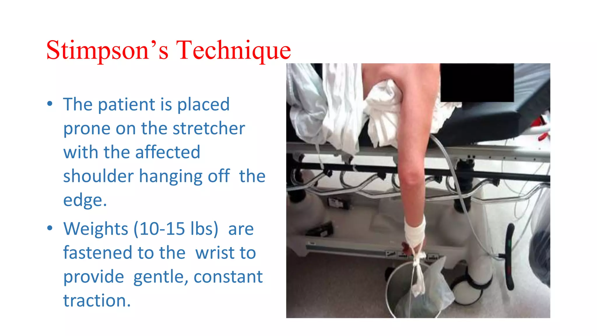 Shoulder joint instability | PPT