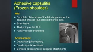 SHOULDER JOINT LIGAMENTS & CAPSULE-RADIOLOGY.pptx