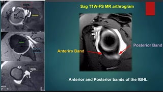 SHOULDER JOINT LIGAMENTS & CAPSULE-RADIOLOGY.pptx