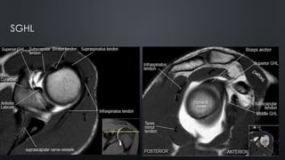 SHOULDER JOINT LIGAMENTS & CAPSULE-RADIOLOGY.pptx