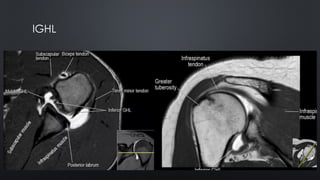 SHOULDER JOINT LIGAMENTS & CAPSULE-RADIOLOGY.pptx