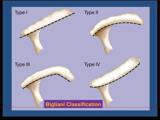 Shoulder joint xray & usg by Dr Soumitra Halder | PPT