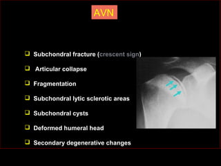Shoulder joint xray & usg by Dr Soumitra Halder | PPT