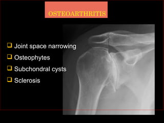 Shoulder joint xray & usg by Dr Soumitra Halder | PPT