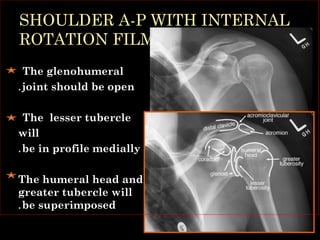 Internal Rotation Shoulder Xray